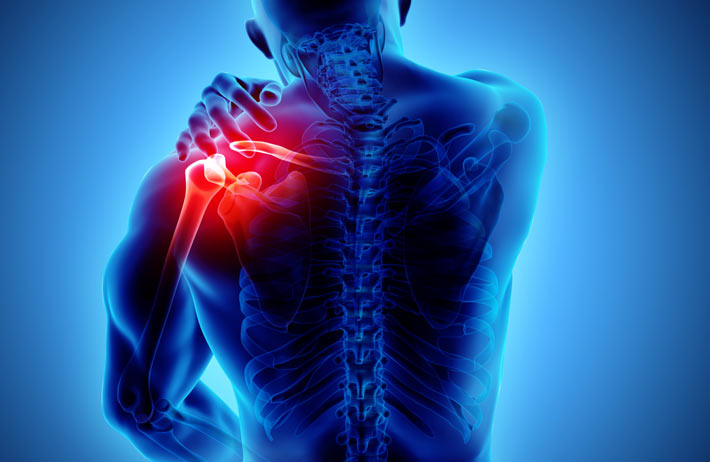 Dolore Al Braccio Sinistro: Cause